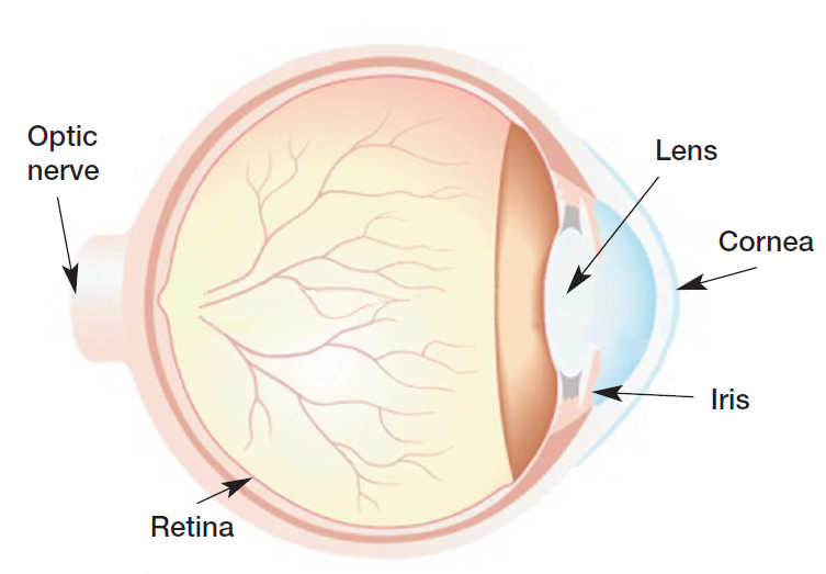 General Information on Cataract : Bausch + Lomb